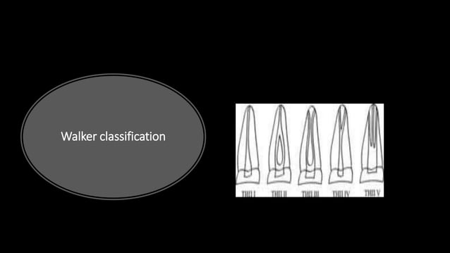 Internal Anatomy of Pulp cavity | PPTX | Dental Health | Diseases and ...