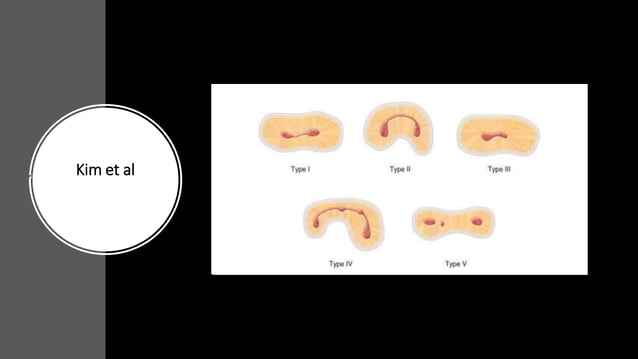 Internal Anatomy of Pulp cavity | PPTX | Dental Health | Diseases and ...