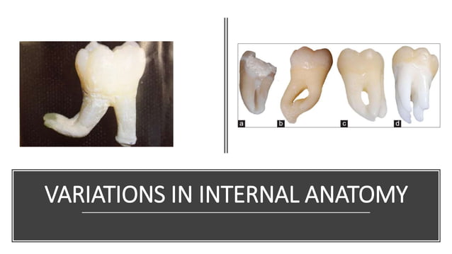 Internal Anatomy of Pulp cavity | PPTX | Dental Health | Diseases and ...