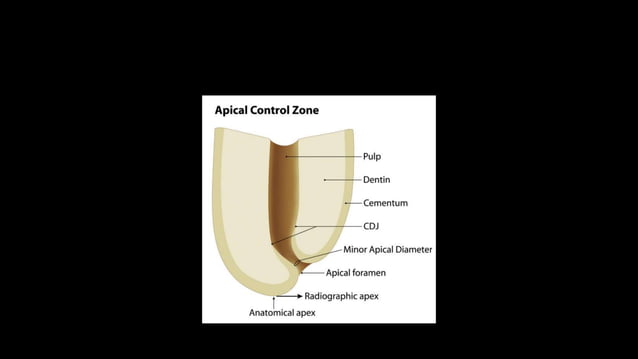 Internal Anatomy of Pulp cavity | PPTX | Dental Health | Diseases and ...