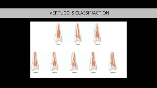 Internal Anatomy of Pulp cavity | PPTX | Dental Health | Diseases and ...