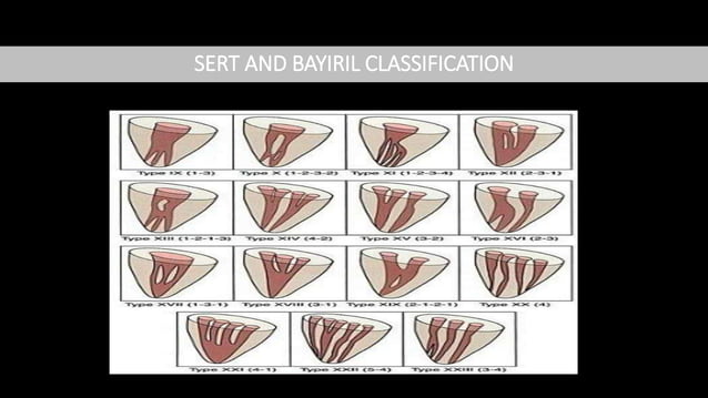Internal Anatomy of Pulp cavity | PPTX | Dental Health | Diseases and ...