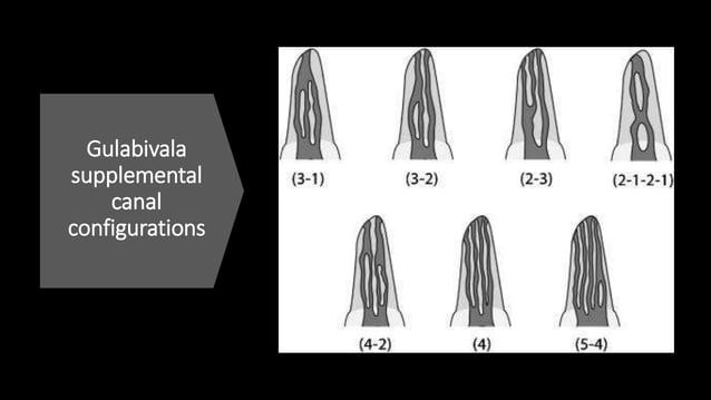 Internal Anatomy of Pulp cavity | PPTX | Dental Health | Diseases and ...