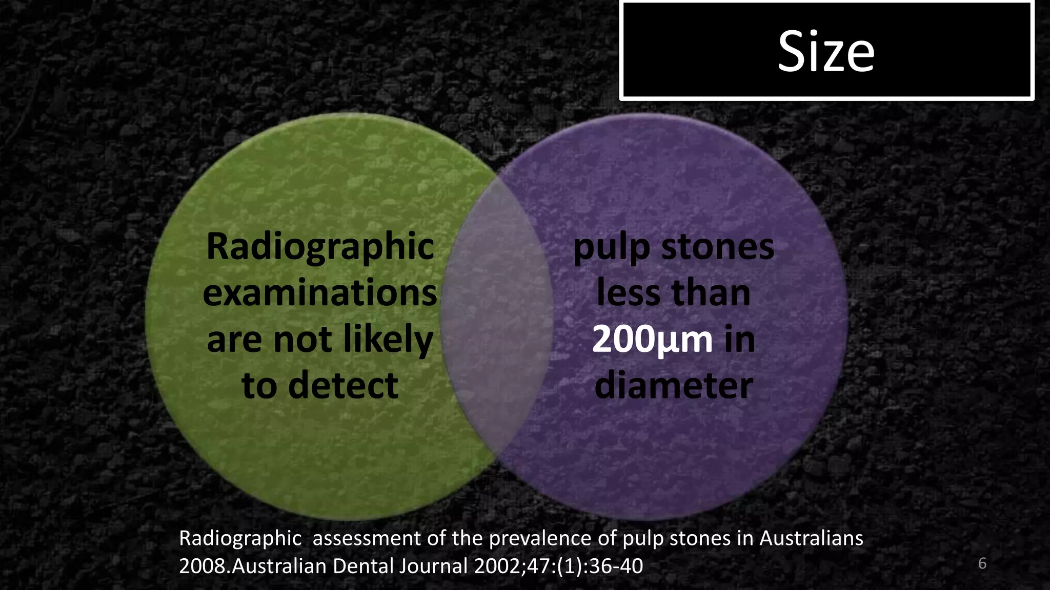 Pulp stone | PPTX