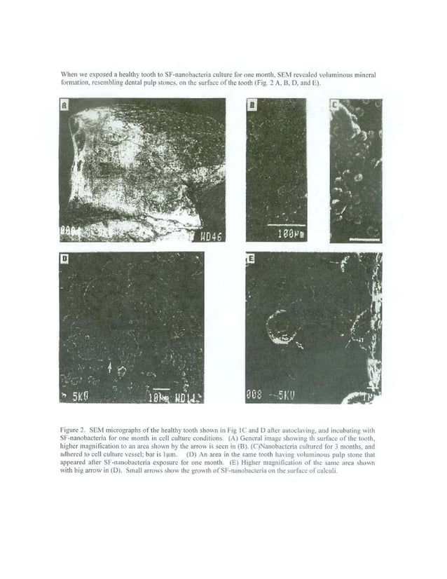 Pulp stones formation pdf | PDF