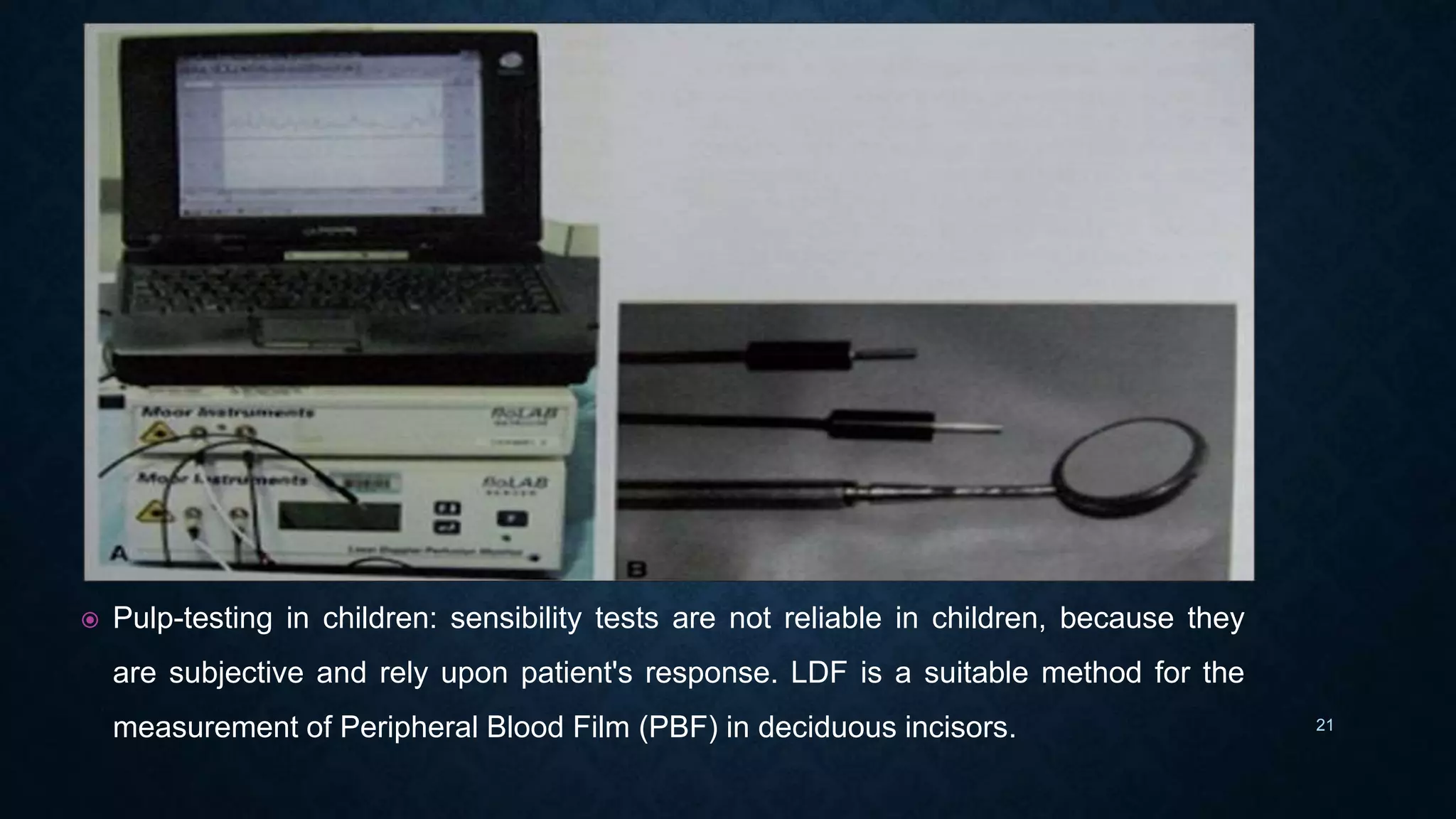 DR SHAKIR Pulp testing | PPTX