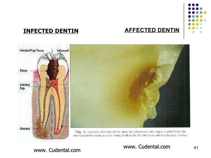 Pulp Therapy by nishtha