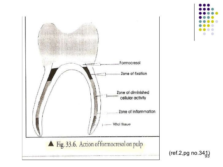 Pulp Therapy by nishtha