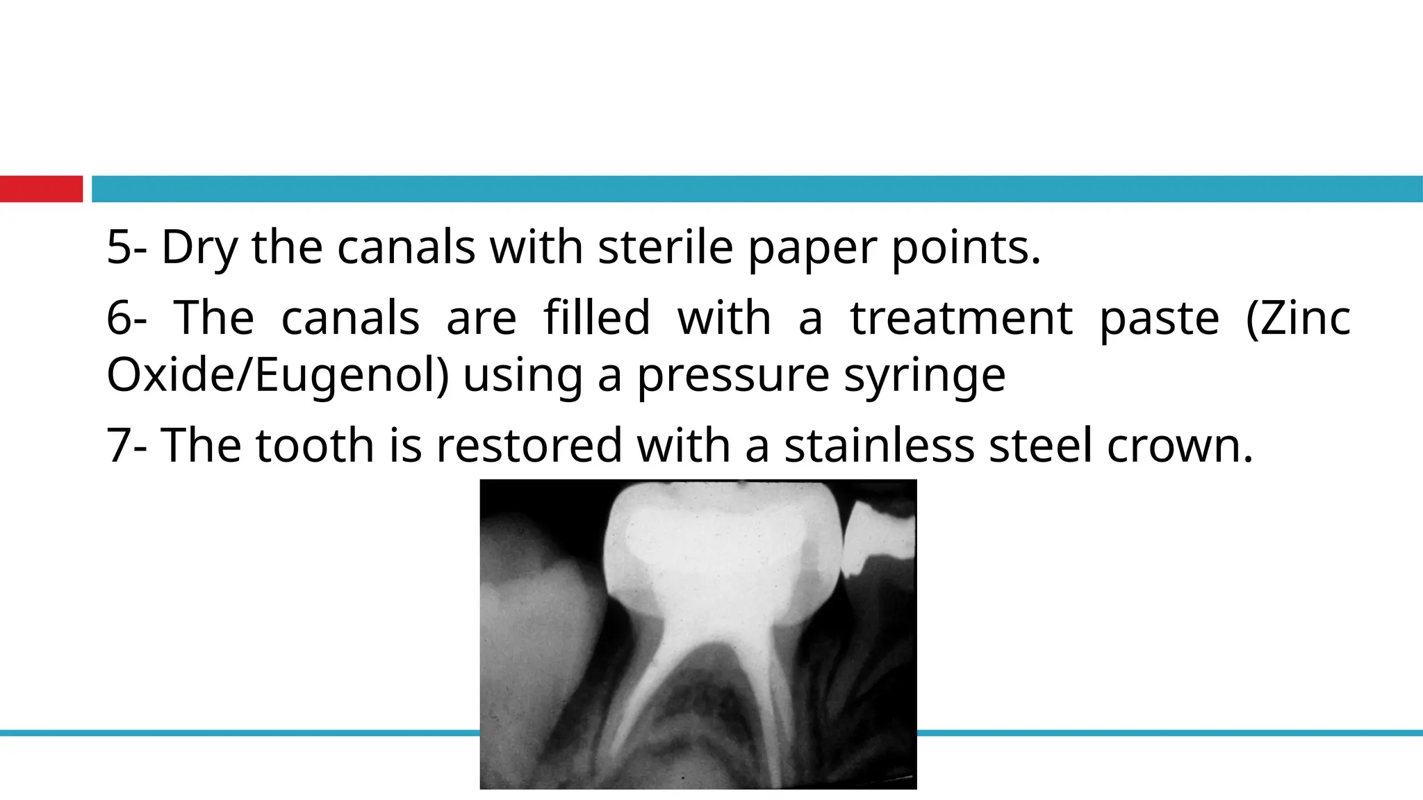 Pulp therapy.pptx in dentistry chaldraine | PPT