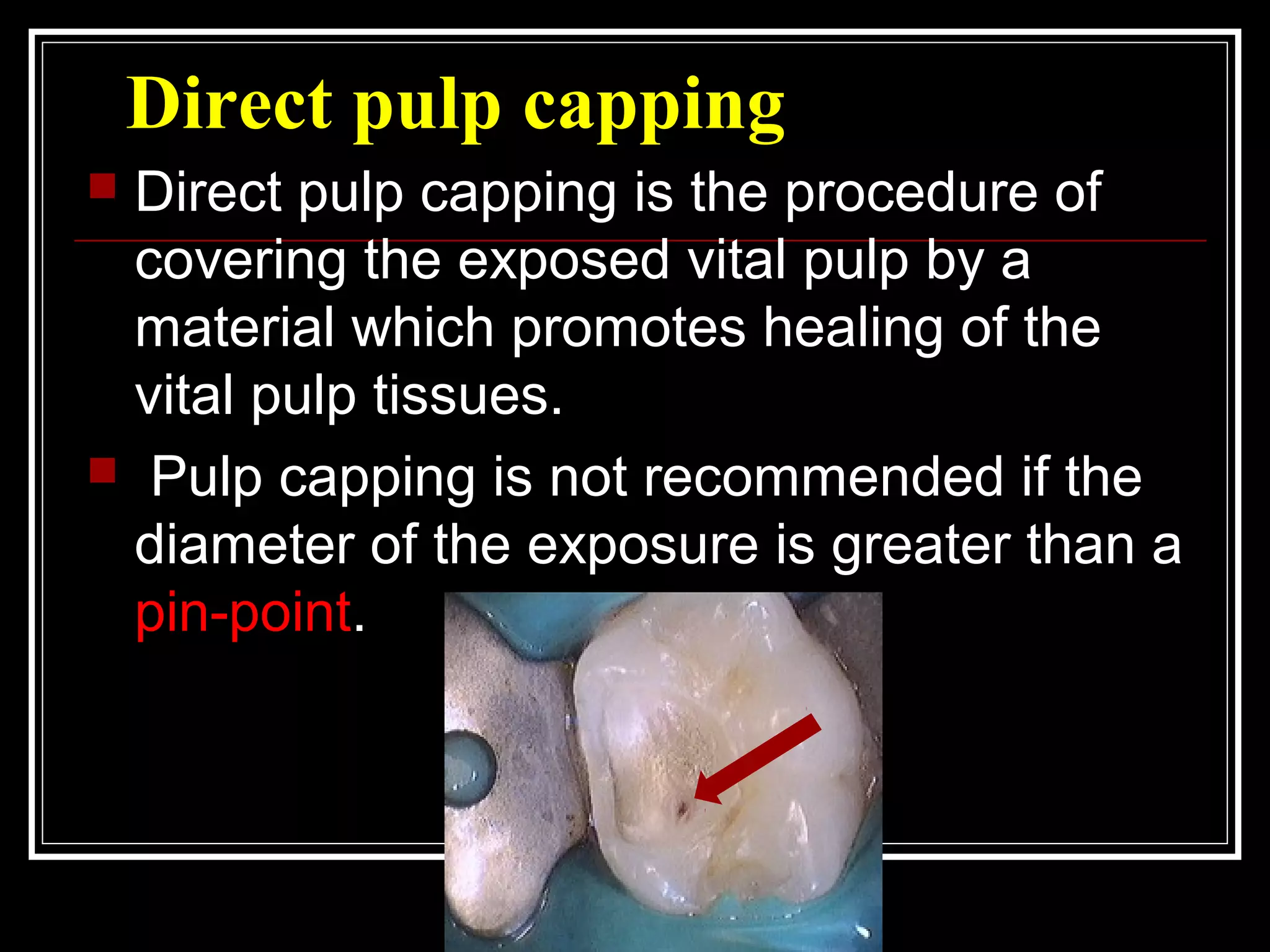 Pulp therapy for primary and young teeth | PPT