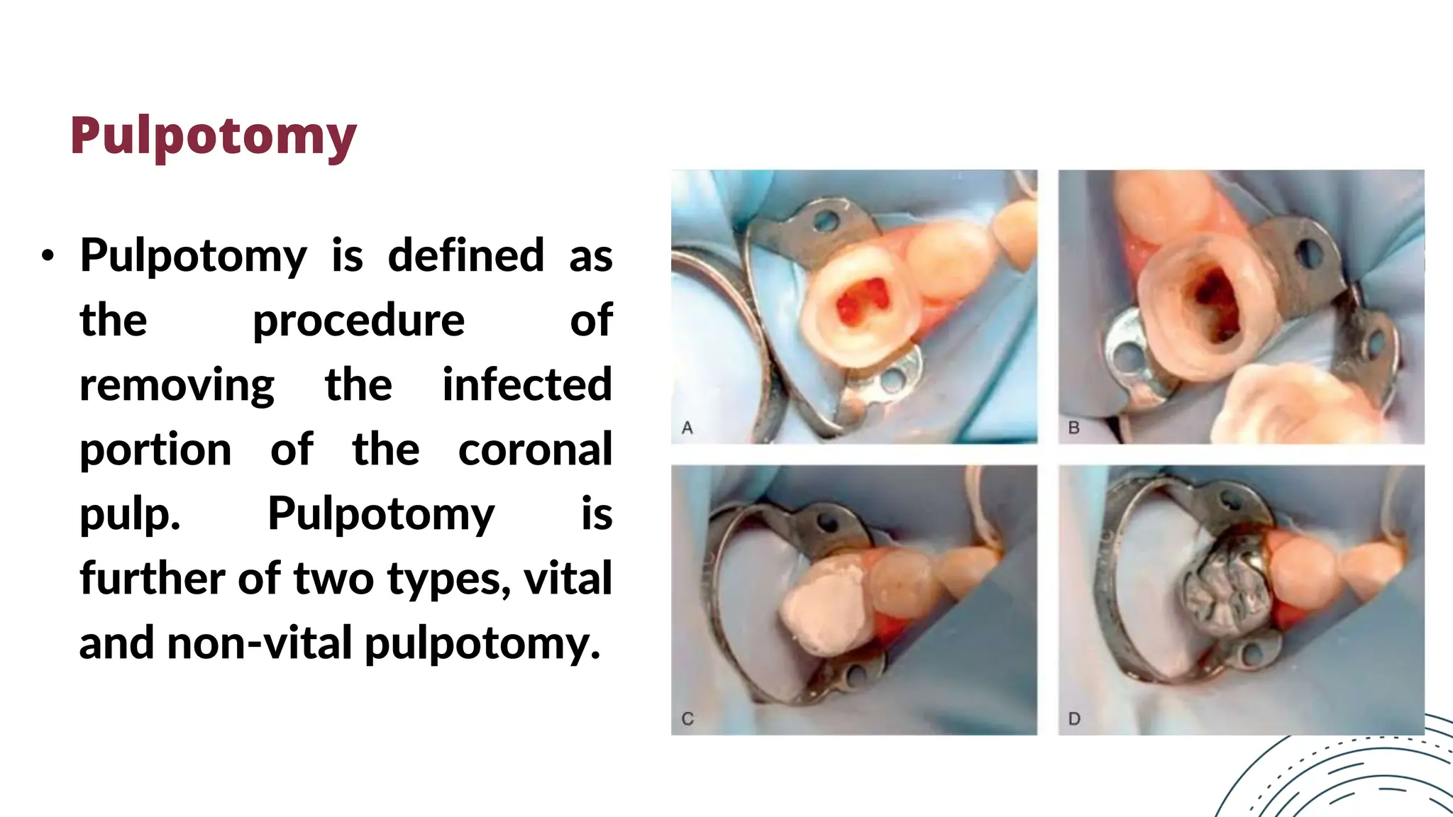 Pulp therapy for primary dentition..pptx