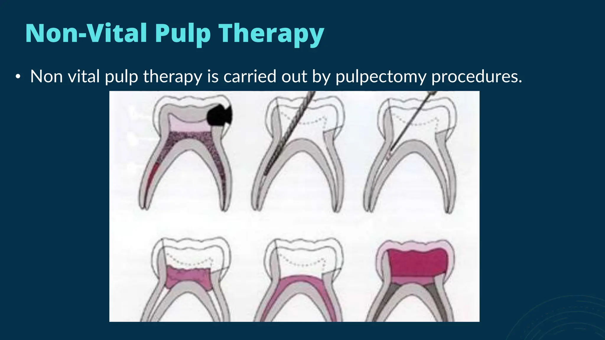 Pulp therapy for primary dentition..pptx