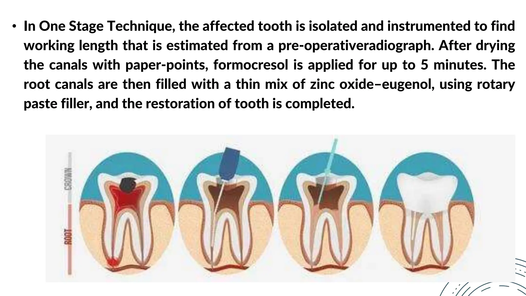 Pulp therapy for primary dentition..pptx