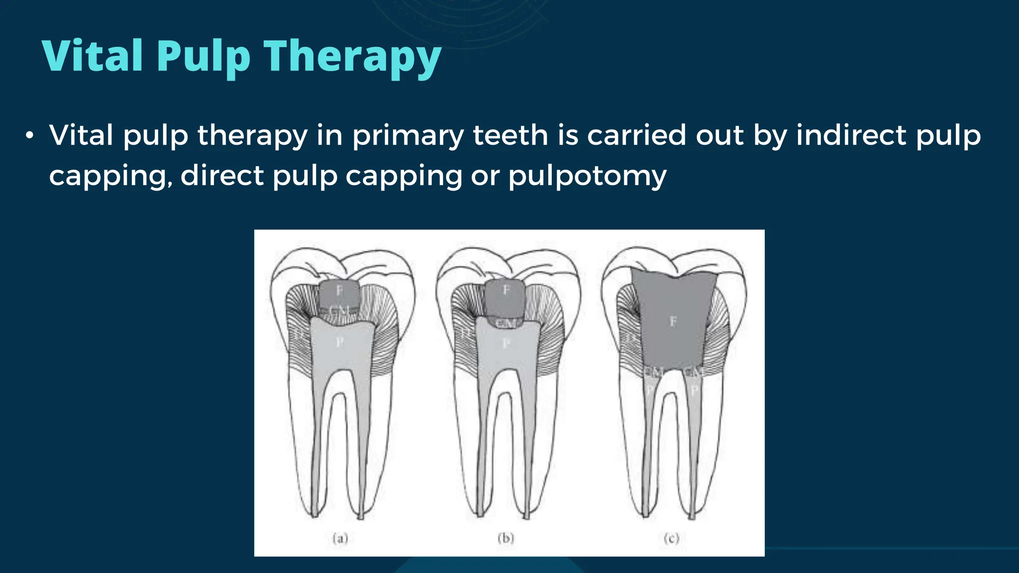 Pulp therapy for primary dentition..pptx