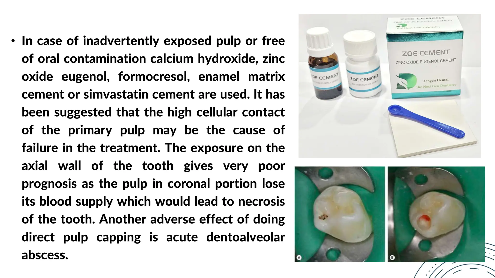 Pulp therapy for primary dentition..pptx