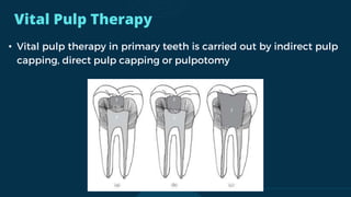 Pulp therapy for primary dentition..pptx