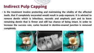 Pulp therapy for primary dentition..pptx