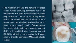 Pulp therapy for primary dentition..pptx