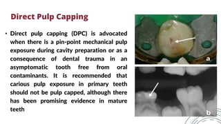 Pulp therapy for primary dentition..pptx