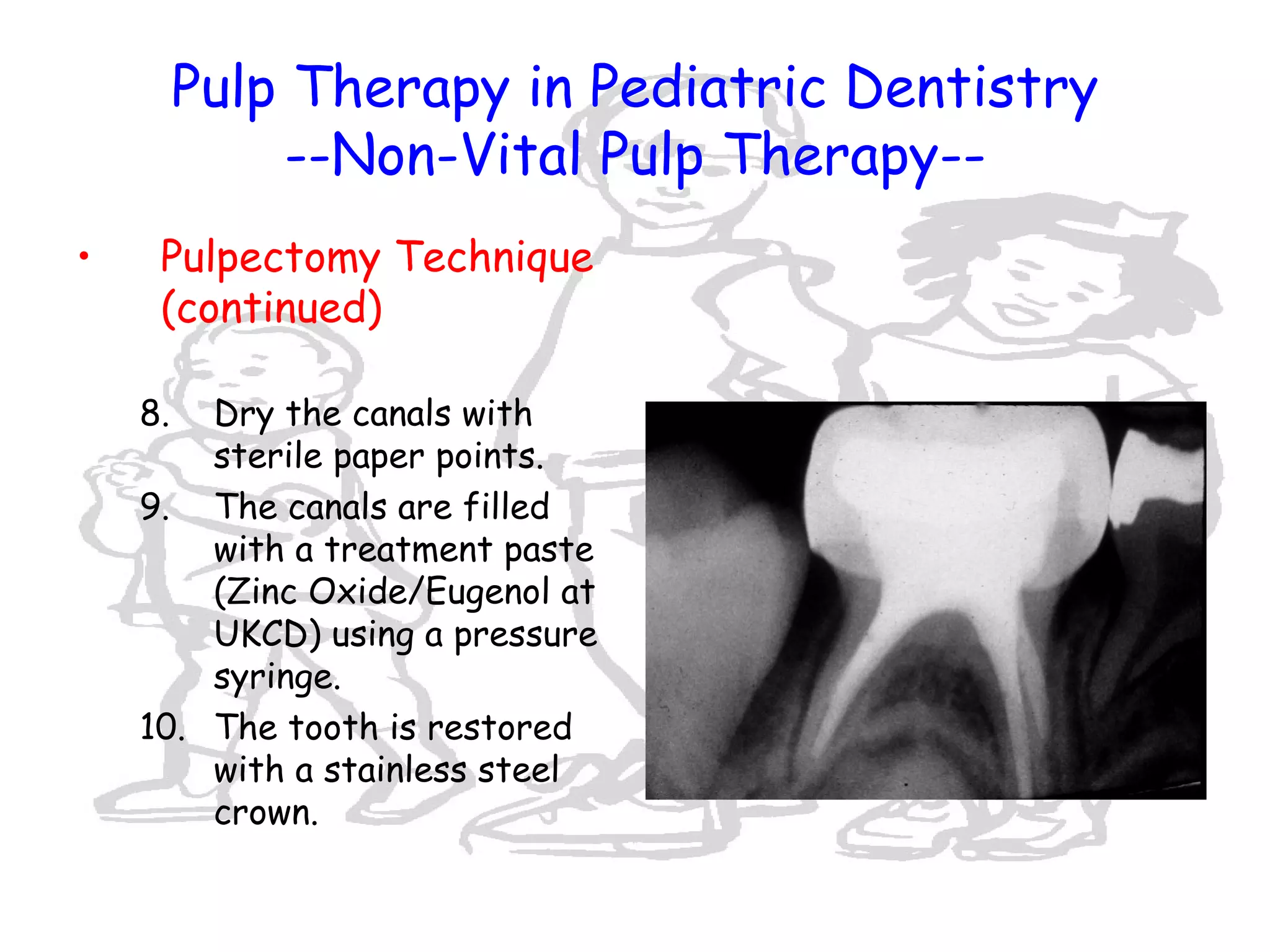 Pulp therapy in pediatric dentistry revised 2 | PPT