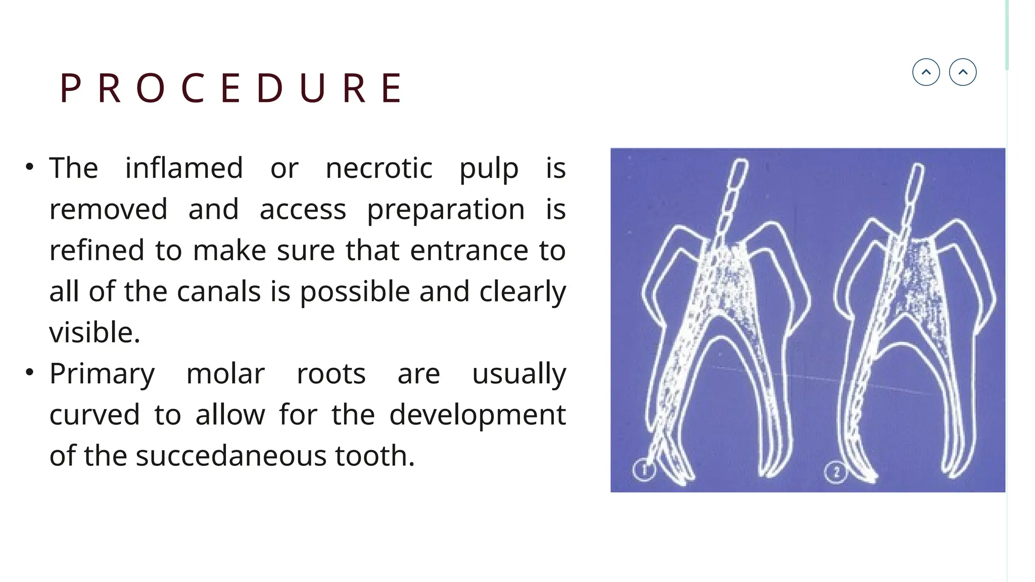 PULP therapy in primary teeth..... pptx | PPTX