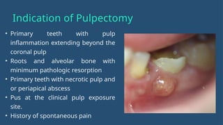 PULP therapy in primary teeth..... pptx | PPTX
