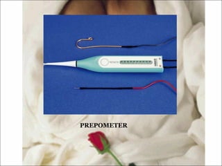 Pulp treatment modalities | PPT