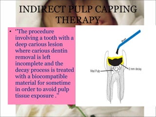 Pulp treatment modalities | PPT