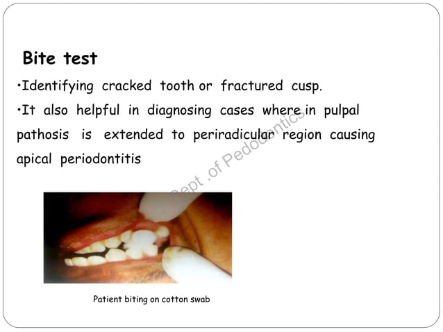 Pulp vitality test new | PPT | Dental Health | Diseases and Conditions