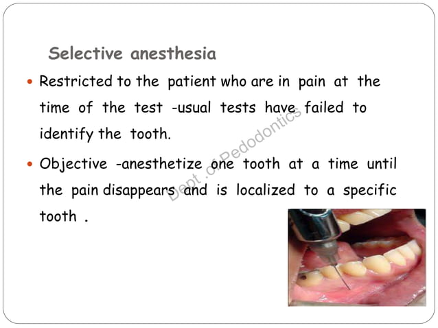 Pulp vitality test new | PPT | Dental Health | Diseases and Conditions