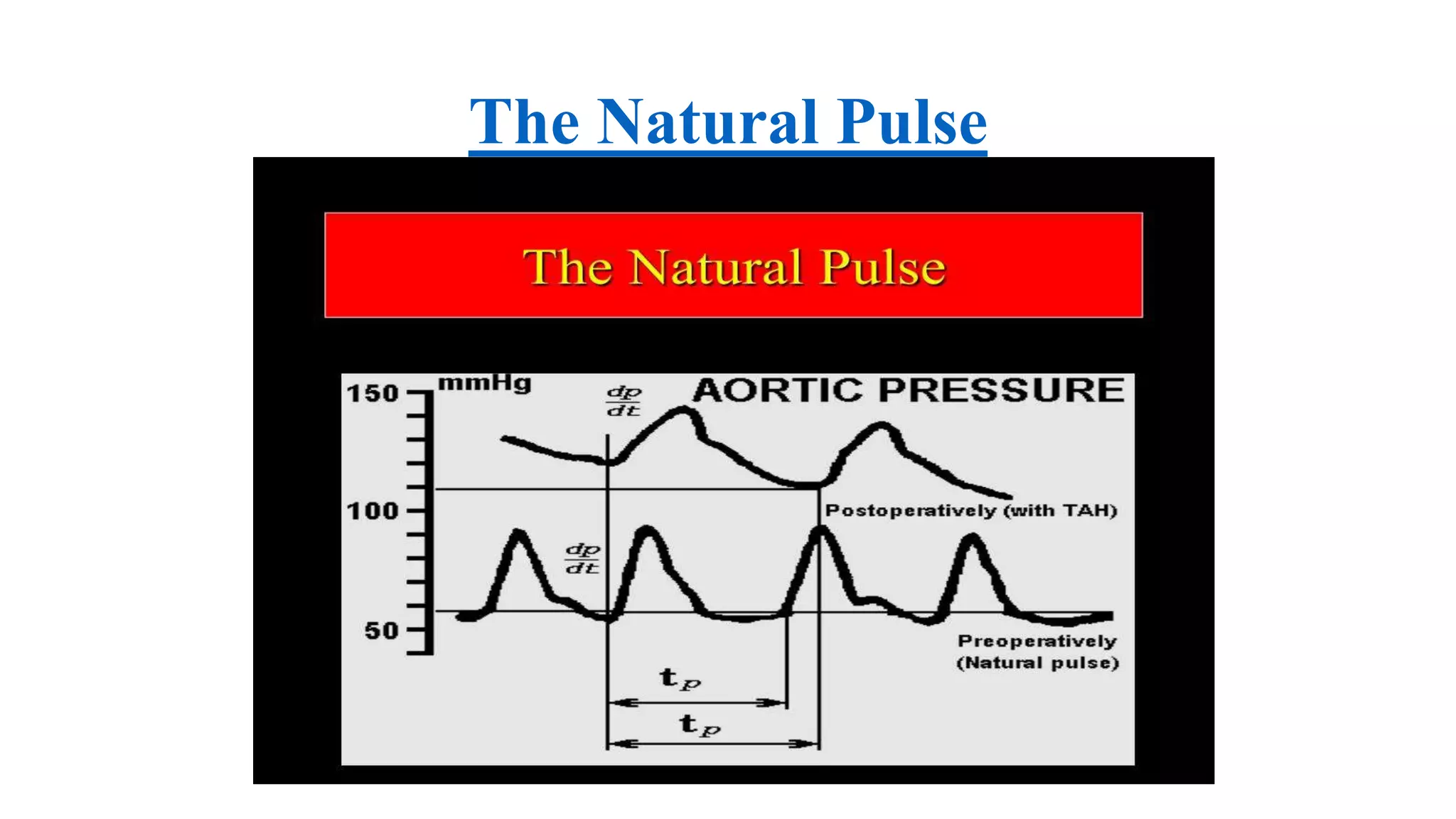 Pulsatile vs non pulsatile perfusion | PPTX