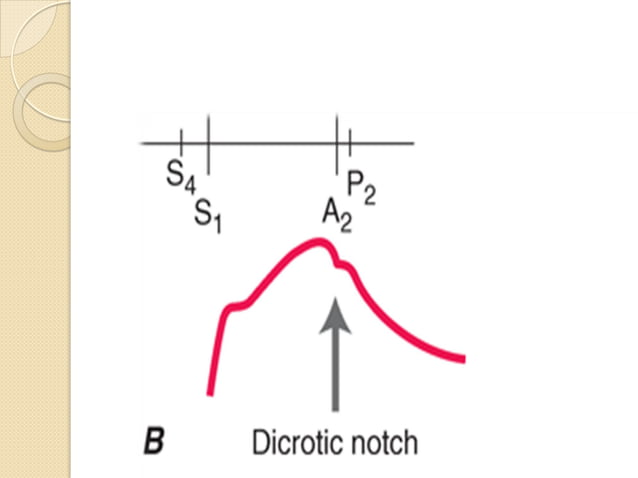 Pulse- Abnormal Findings | PDF