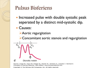 Pulse- Abnormal Findings | PPT