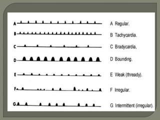 Pulse .ppt | Free Download
