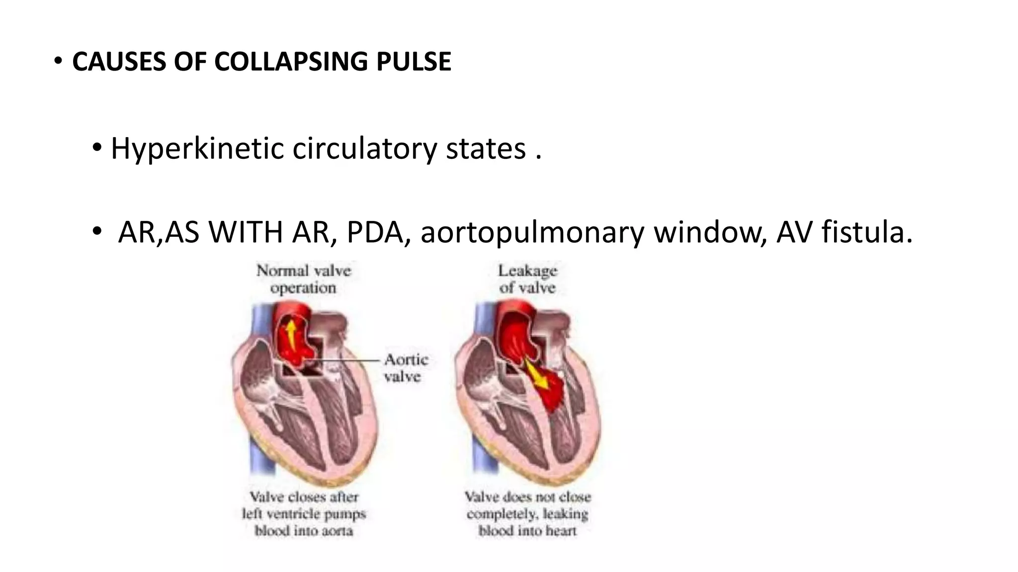 Pulse - Arterial Pulse - Types | PPTX | Heart and Cardiovascular ...