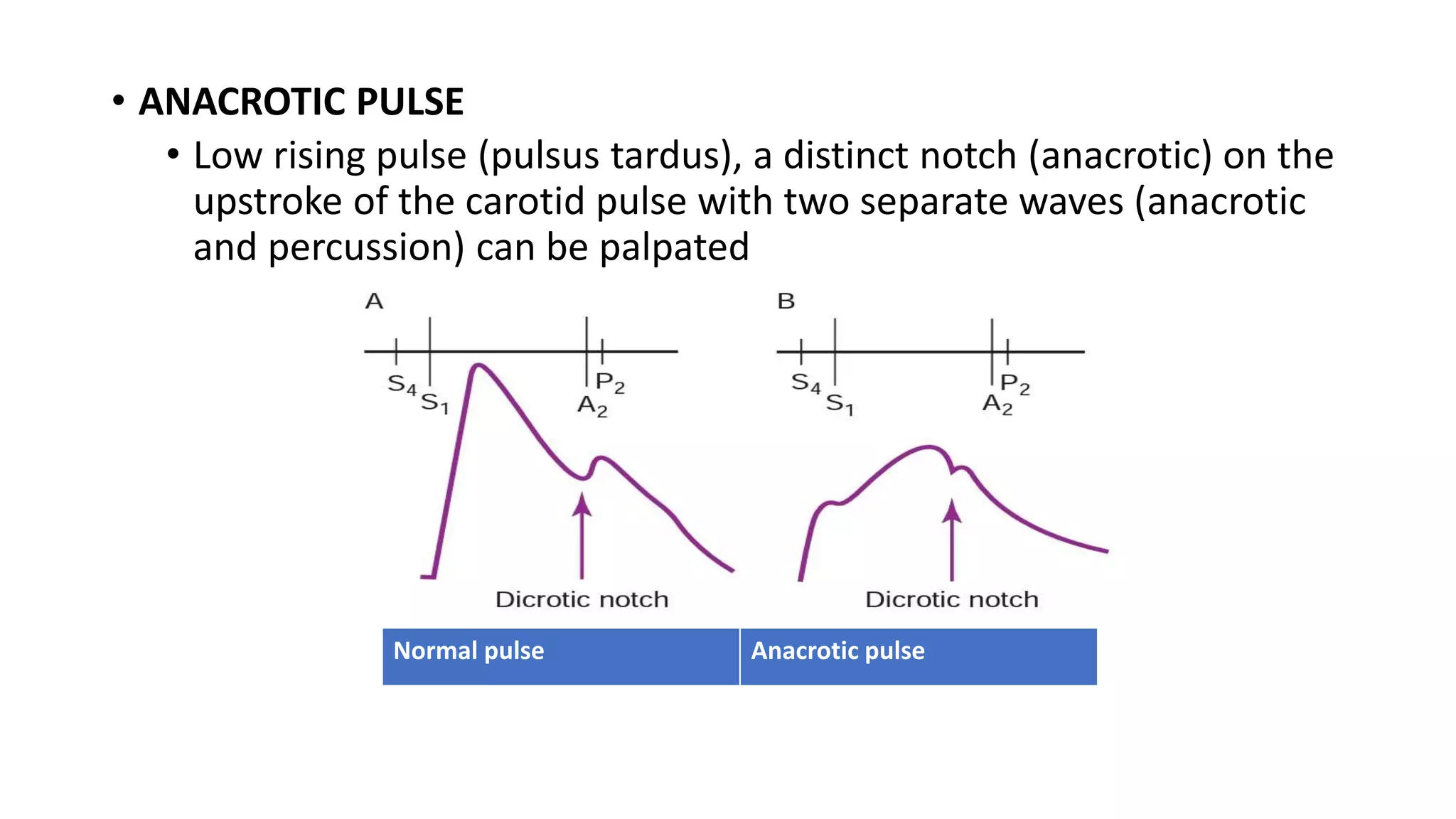 Pulse - Arterial Pulse - Types | PPTX