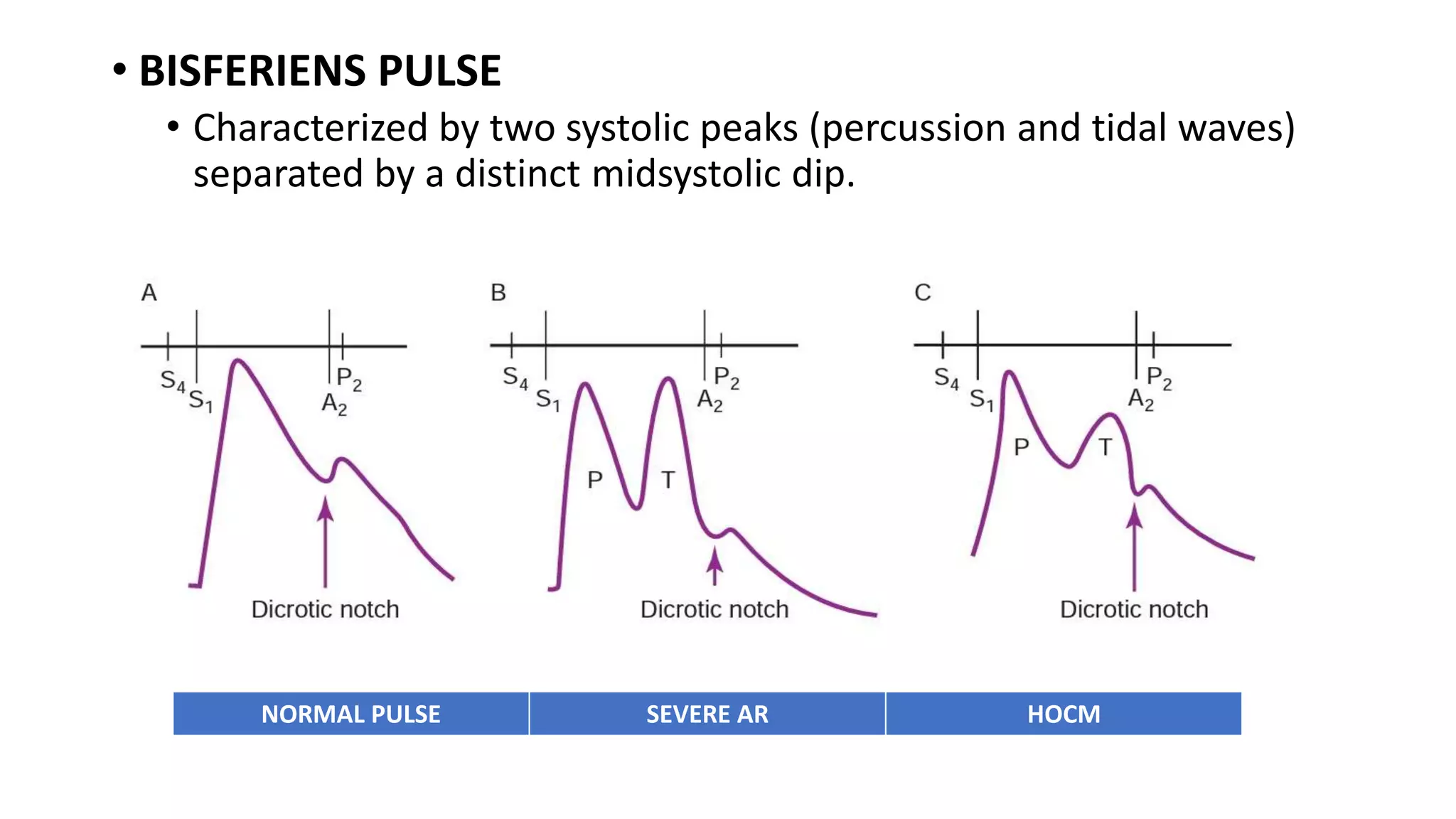 Pulse - Arterial Pulse - Types | PPTX