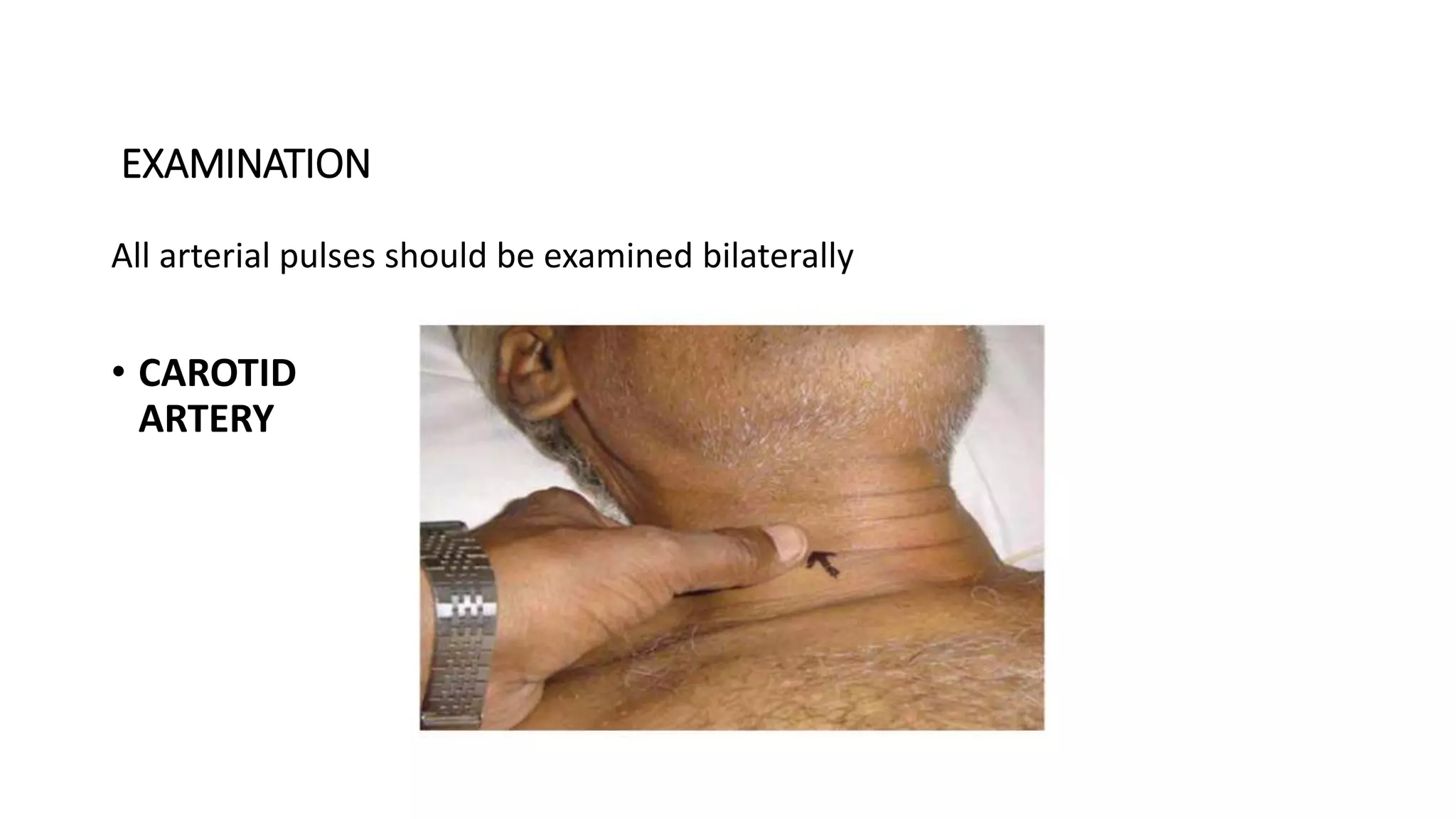 Pulse - Arterial Pulse - Types | PPTX | Heart and Cardiovascular ...