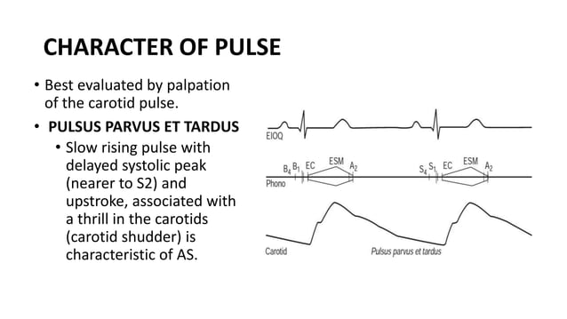 Pulse - Arterial Pulse - Types | PPTX | Heart and Cardiovascular ...