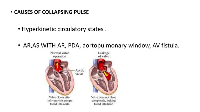 Pulse - Arterial Pulse - Types | PPTX | Heart and Cardiovascular ...