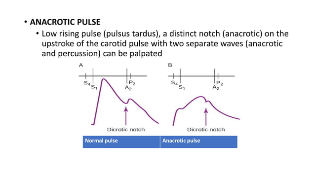 Pulse - Arterial Pulse - Types | PPTX | Heart and Cardiovascular Diseases | Diseases and Conditions