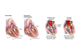 Pulse - Arterial Pulse - Types | PPTX
