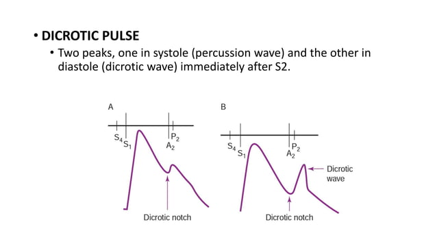 Pulse - Arterial Pulse - Types | PPTX | Heart and Cardiovascular ...