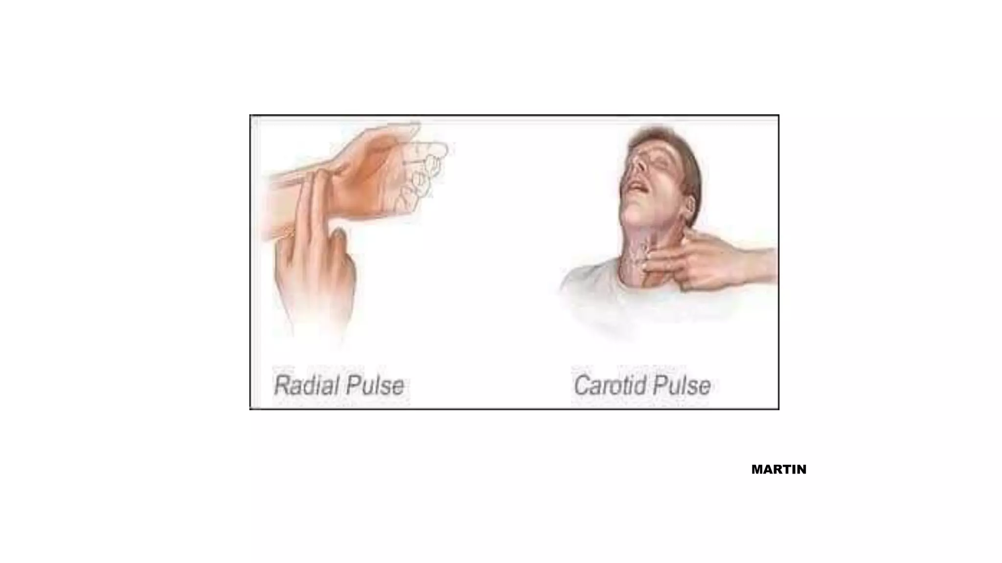 DIFFERENT PULSE SITES (pulse -introduction & images) | PPTX