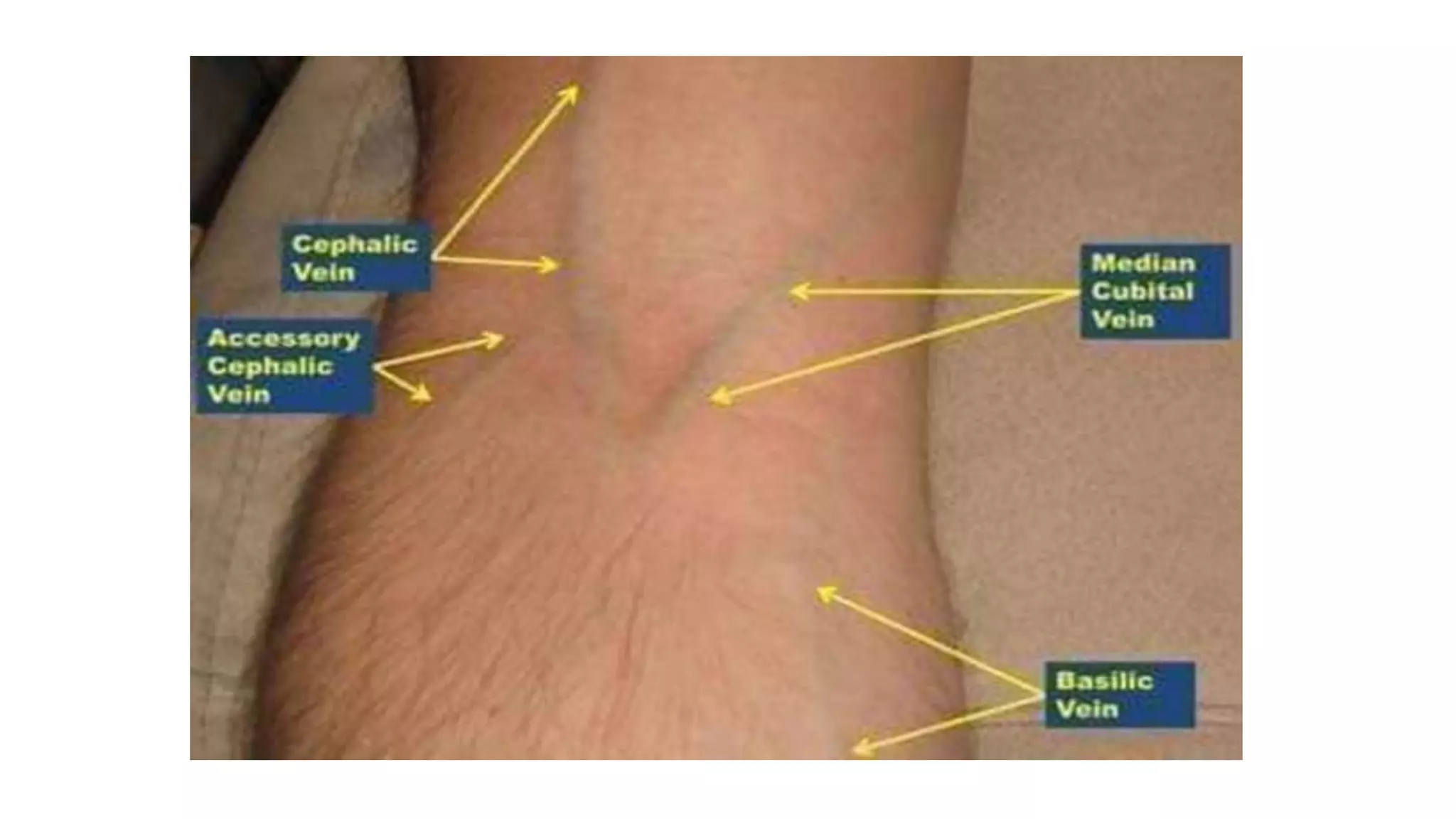 DIFFERENT PULSE SITES (pulse -introduction & images) | PPTX