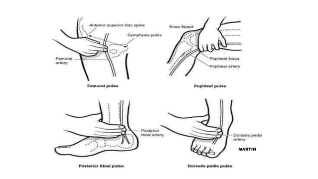 DIFFERENT PULSE SITES (pulse -introduction & images) | PPTX