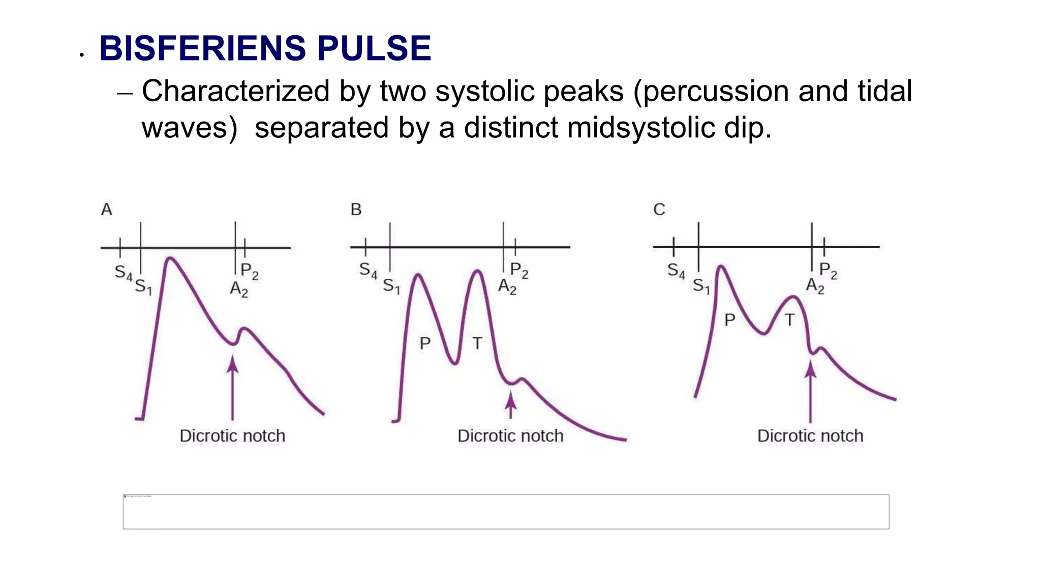pulse.ppt