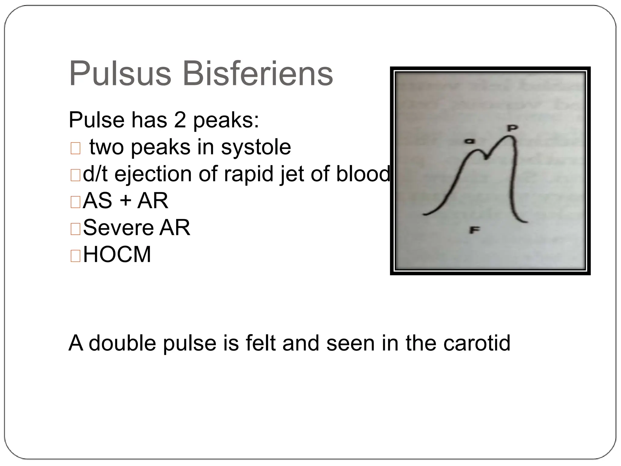 Radial pulse and other peripheral pulses.pptx