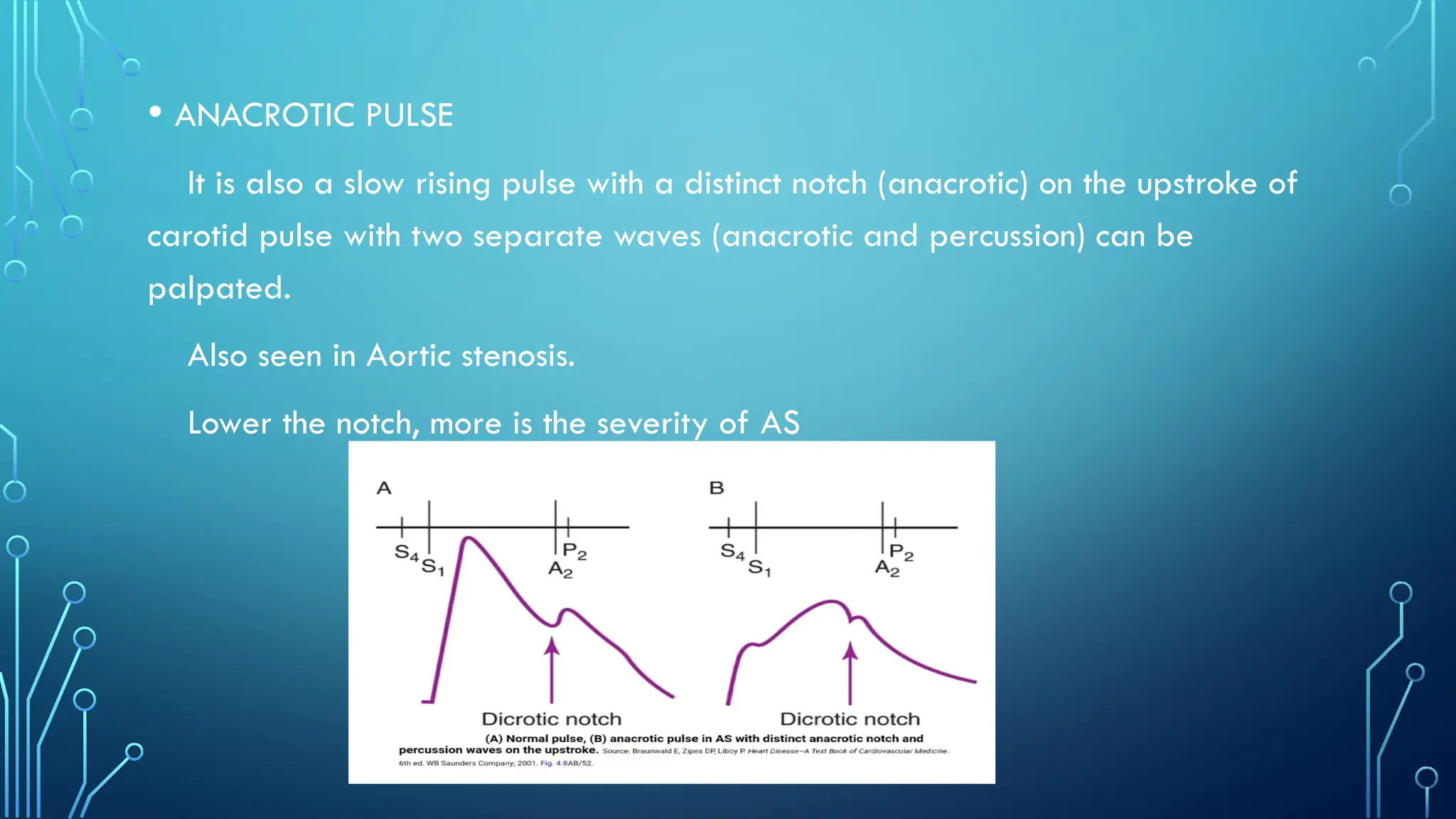 different types of pulse, normal physiology | PPTX