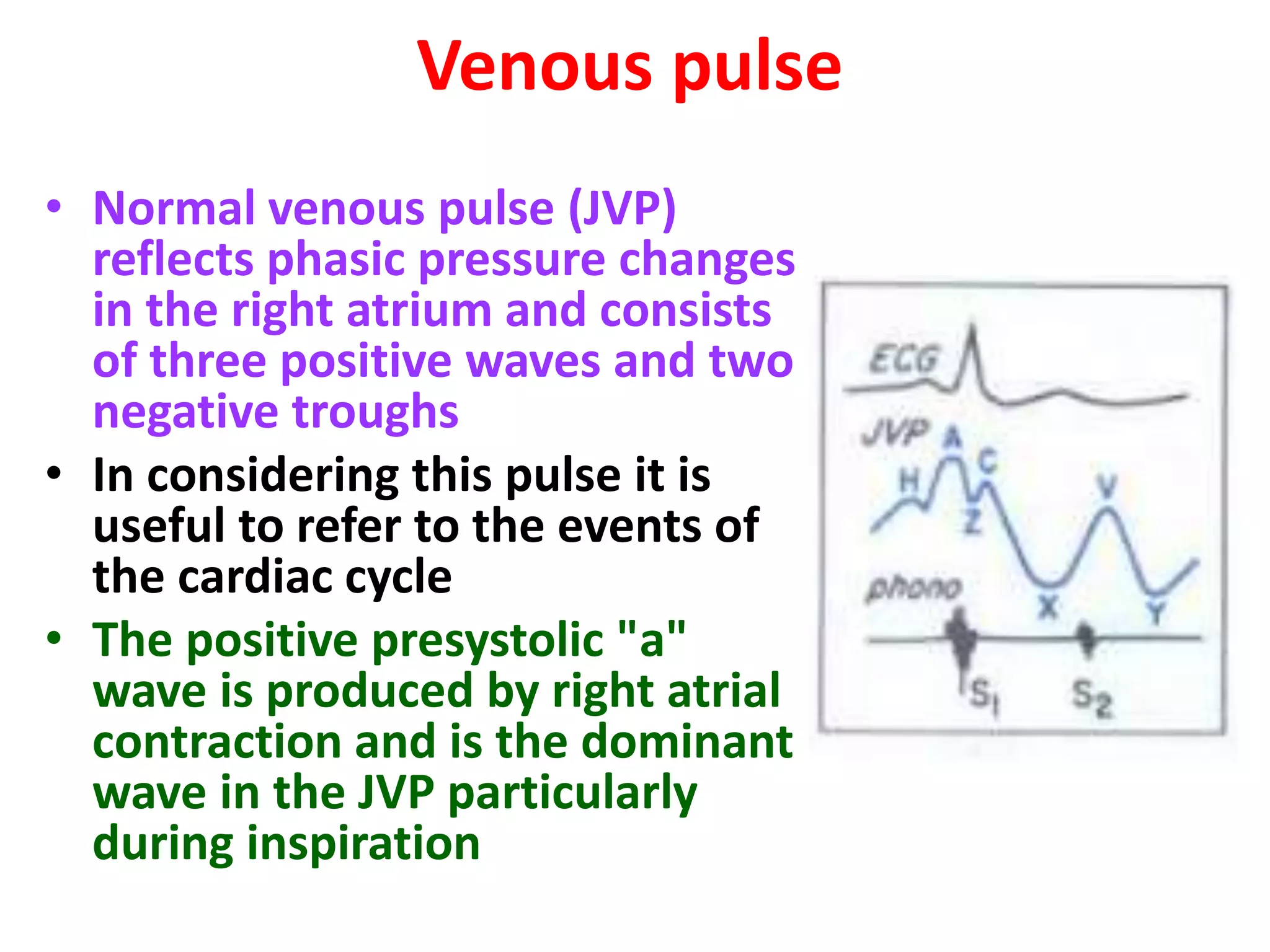 Pulse tripleresponse | PPTX